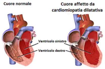 LE MALATTIE CARDIOVASCOLARI – LA CIVILTA' EGIZIA