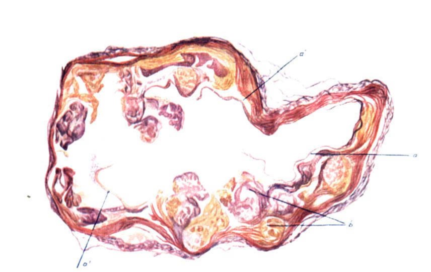 LE MALATTIE CARDIOVASCOLARI – LA CIVILTA' EGIZIA